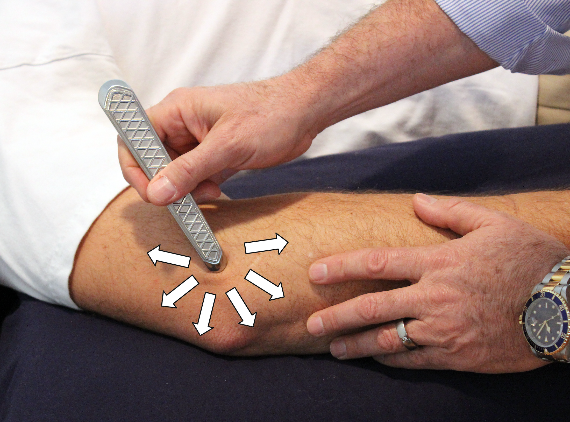 Understanding Lateral Epicondylitis and Effective Tennis Elbow Treatme