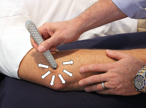 Understanding Lateral Epicondylitis and Effective Tennis Elbow Treatme